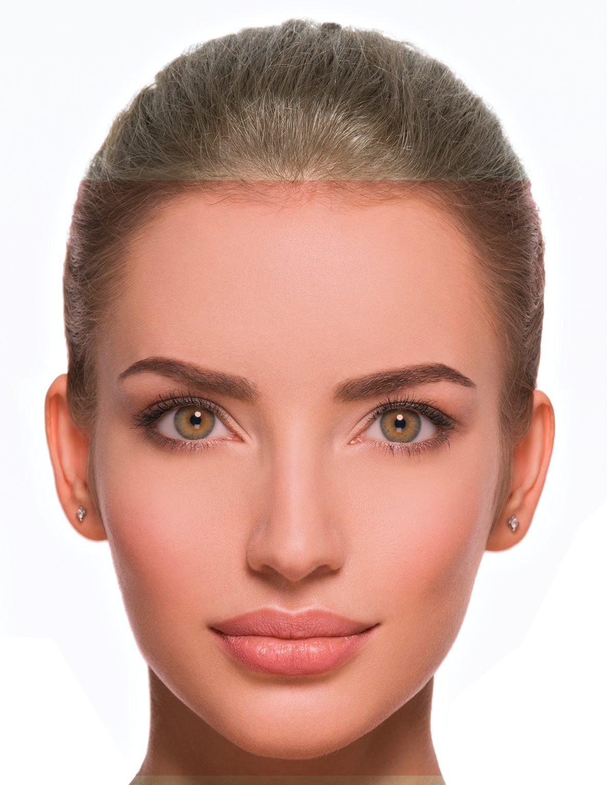Faciales - Rostro - Dra. Alicia Echeverría