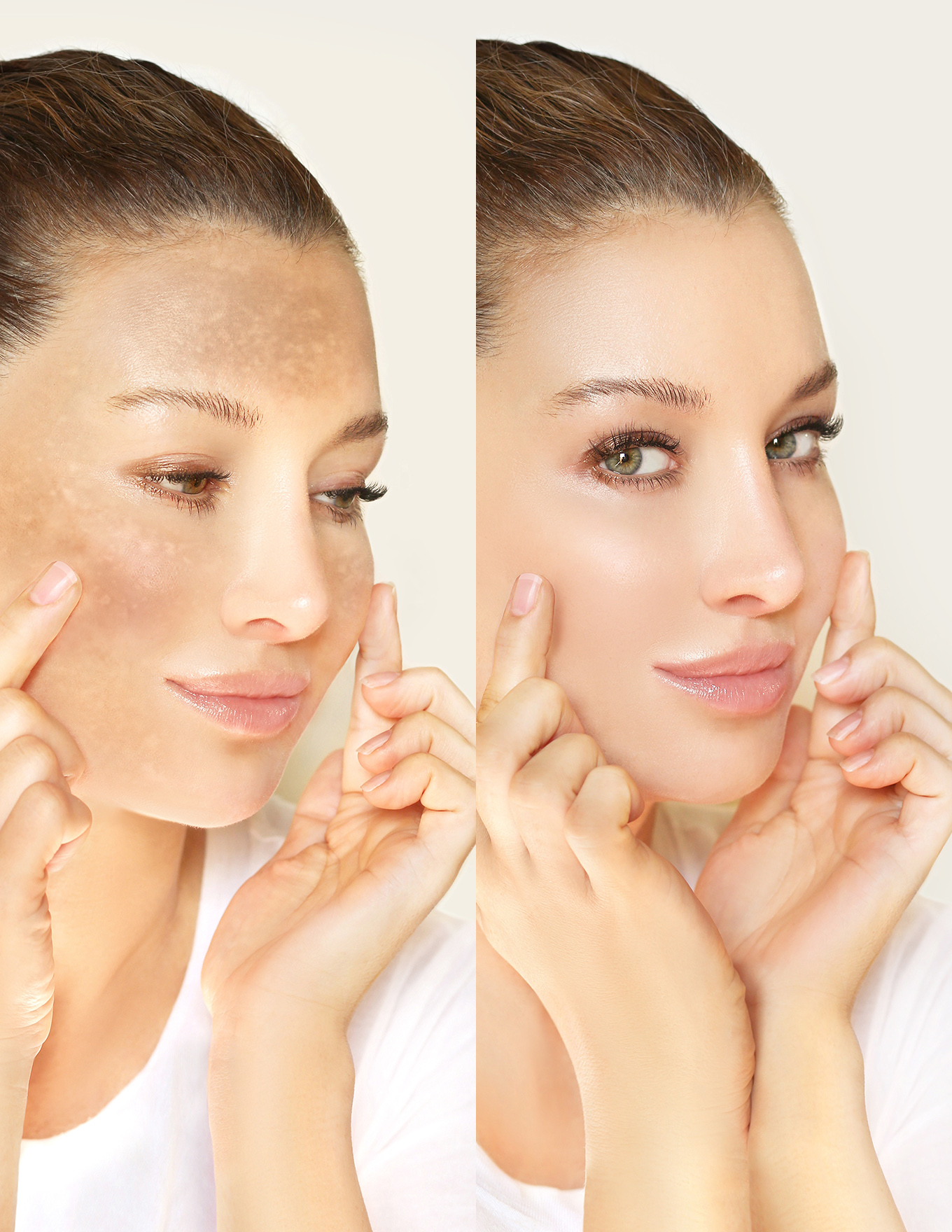 Manchas - Dra. Alicia Echeverría